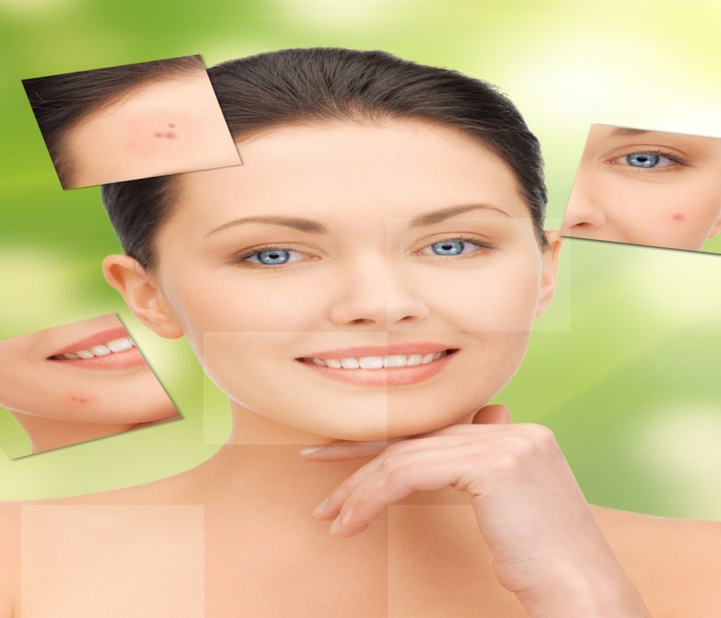 Acne Treatment And Chances Of Reoccurrence Of Acne – Cosmetics and you ...