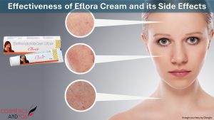 Effectiveness of Eflora Cream and its Side Effects – Cosmetics and you ...
