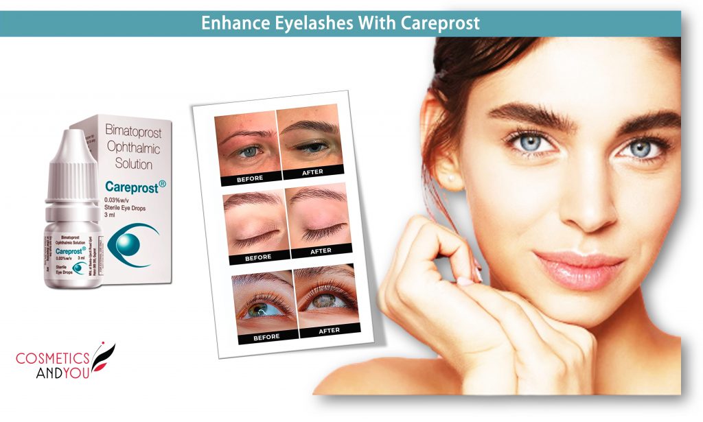 Enhance Eyelashes With Careprost – Cosmetics and you : Acne Treatment ...