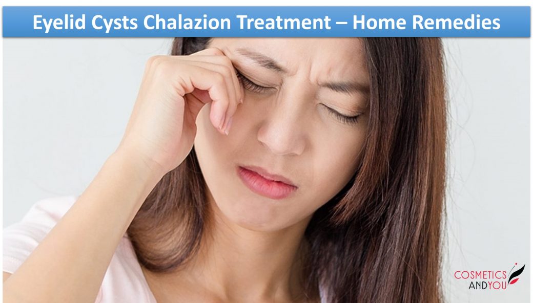 Eyelid Cysts Chalazion Treatment – Home Remedies﻿ – Cosmetics and you ...