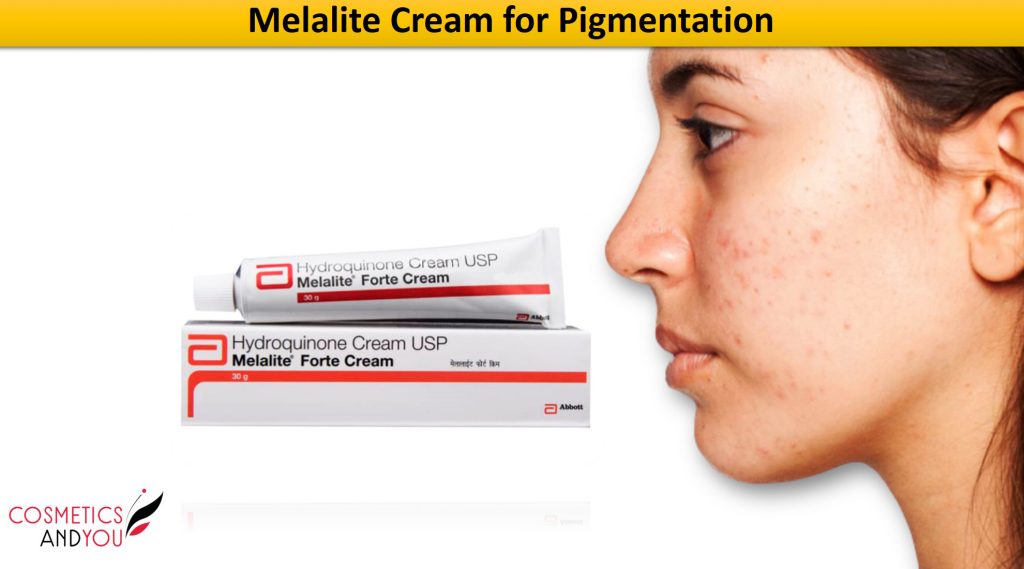 Melalite Hydroquinone Cream for Pigmentation – Cosmetics and you : Acne ...