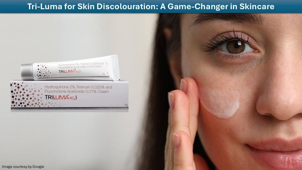 Tri-Luma for Skin Discolouration: A Game-Changer in Skincare ...