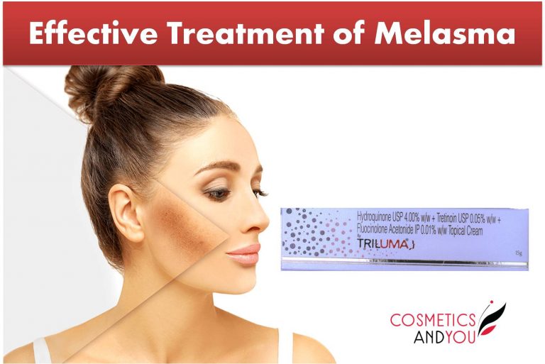 Buy Tri-Luma Cream Online – Cosmetics and you : Acne Treatment ...
