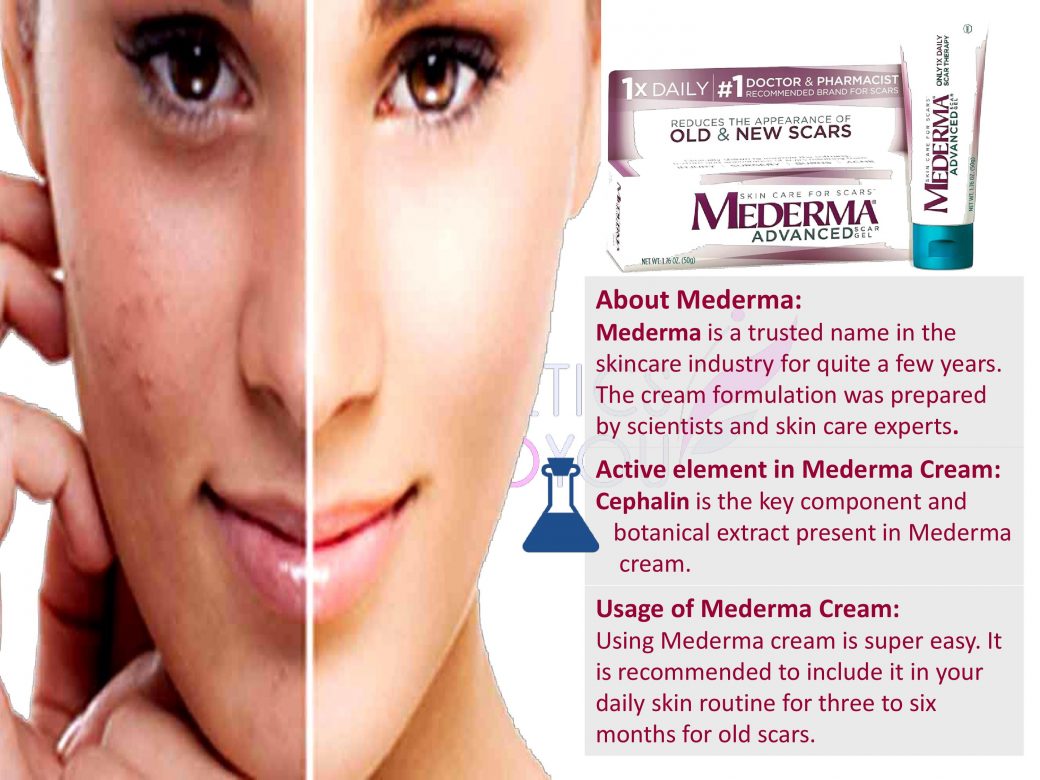 Mederma Cream Reviews for Acne Scars – Cosmetics and you : Acne ...